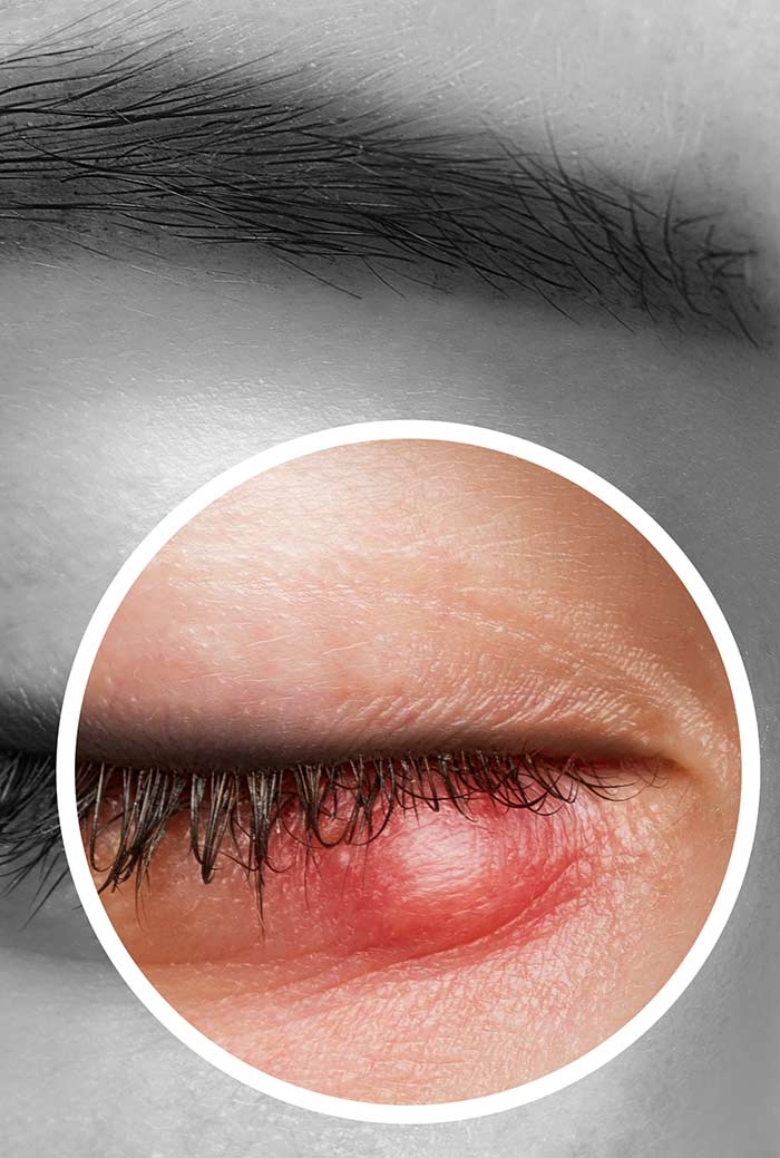 Urgent Eye Care California | Emergency Eye Treatment Near You